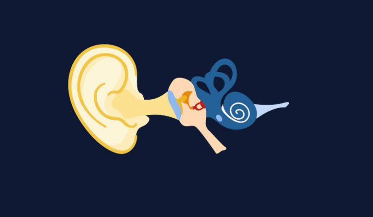 Otosclerosis: qué es